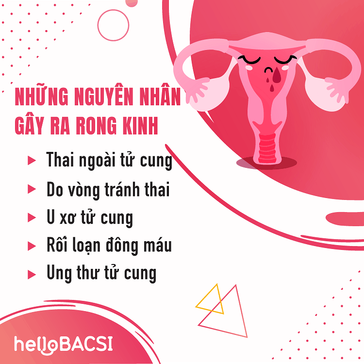 Rong kinh kéo dài là gì? Nguyên nhân dấu hiệu và cách chữa trị